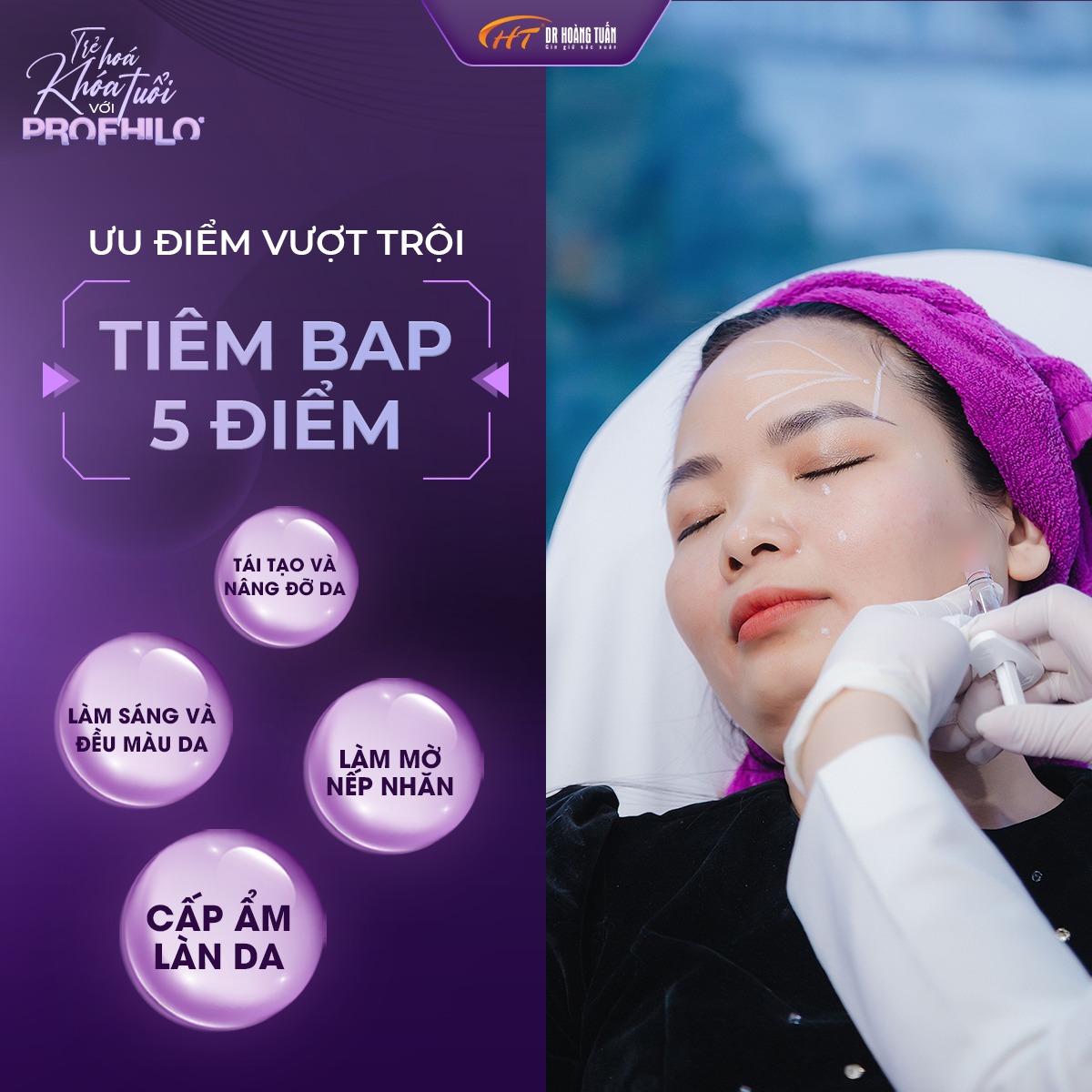 Kỹ thuật tiêm BAP 5 điểm - Nâng cơ trẻ hoá da toàn diện