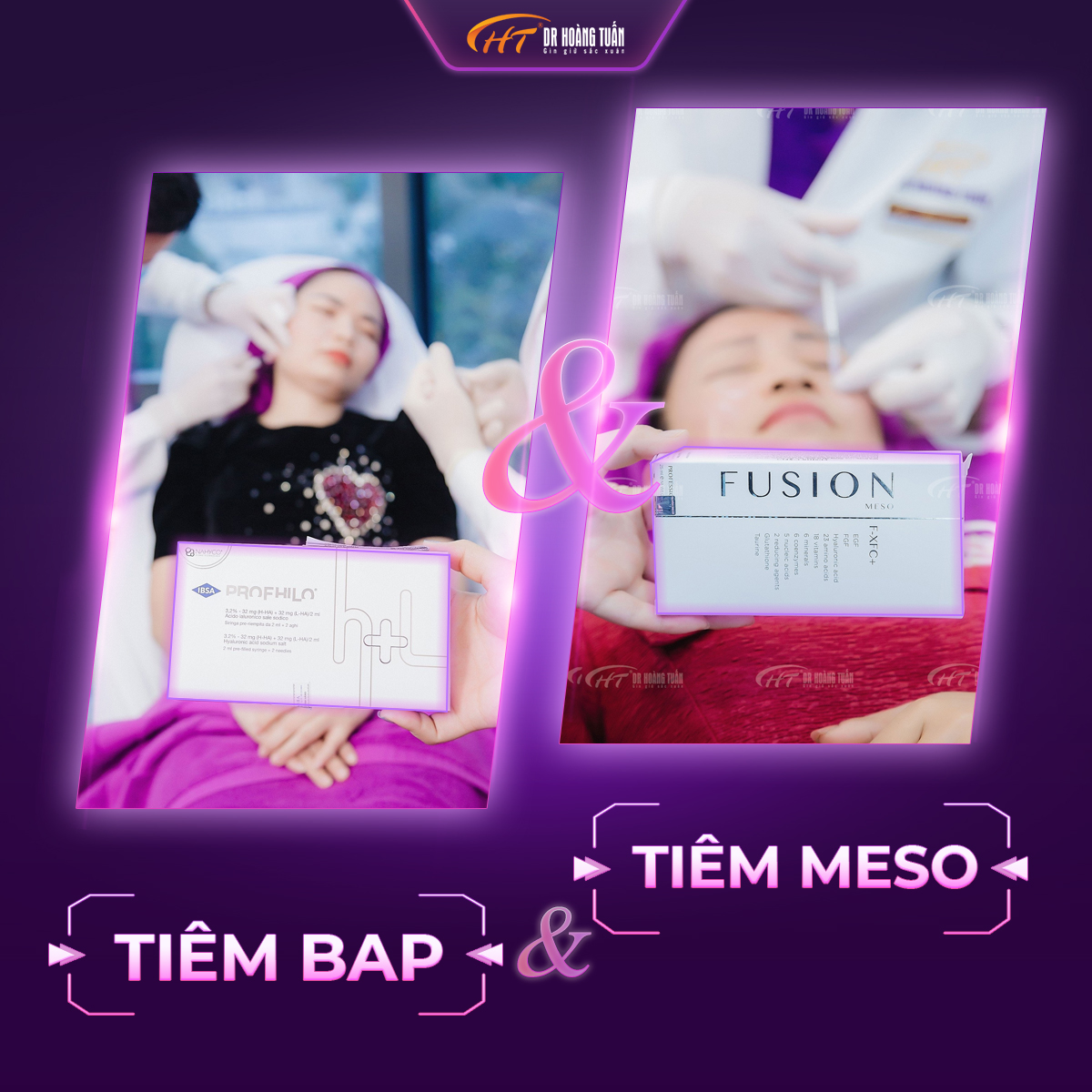 Tiêm Bap và tiêm Meso khác nhau như thế nào?