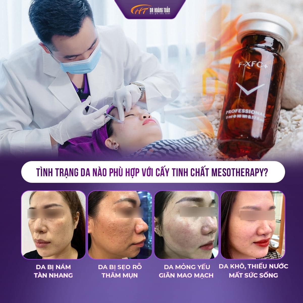 Tiêm Bap và tiêm Meso khác nhau như thế nào?